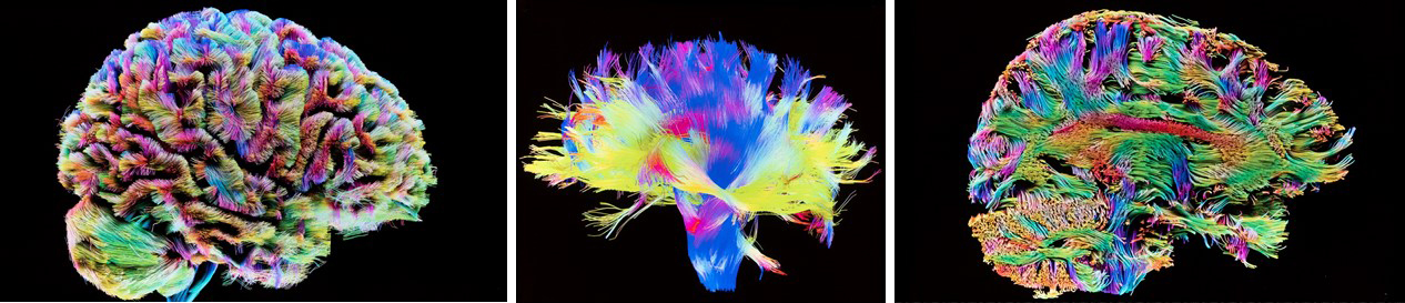 MyBrain - Il Giornale OFF